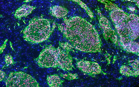 The Media is the Message: How Stem Cells Grow Depends On What They Grow ...