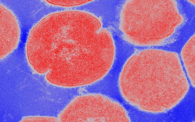 Deadly Bacteria Stiff-Arm the Immune System