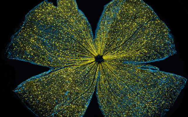 Promise of Gene Therapy for Glaucoma Shines Bright in Award-Winning Image