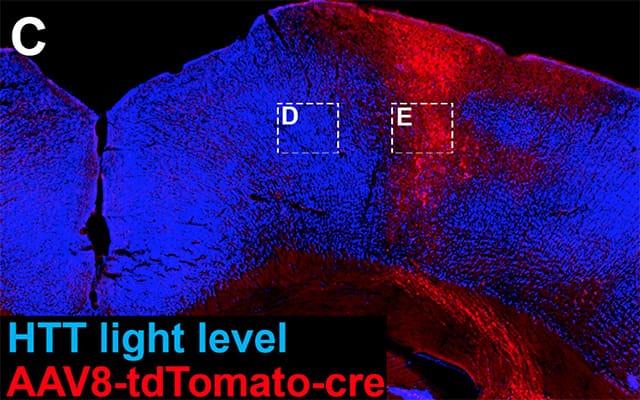 When Damaged, the Adult Brain Repairs Itself by Going Back to the Beginning