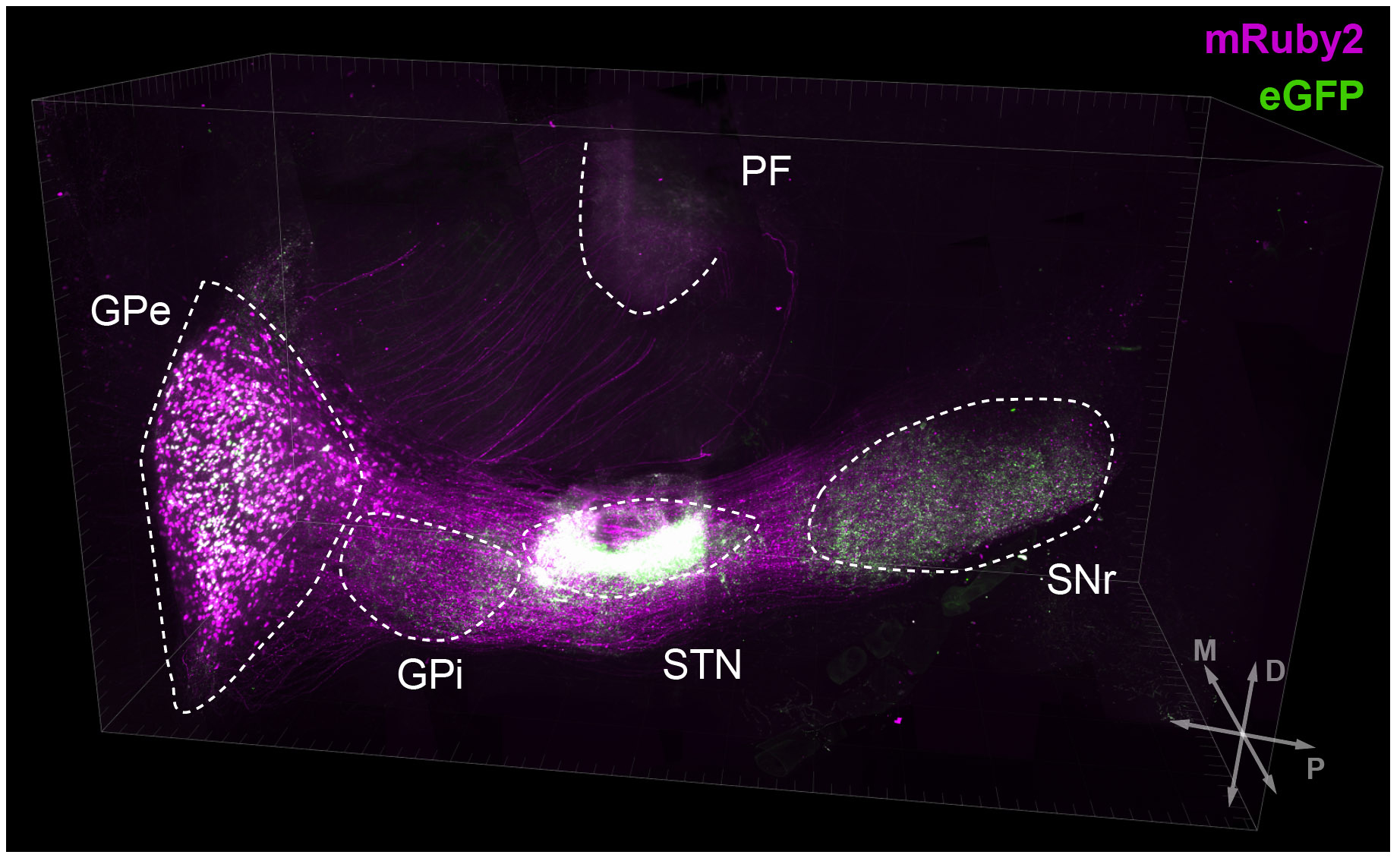 Distinct Parkinson’s Disease Symptoms Tied to Different Brain Pathways