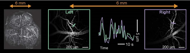UC San Diego Researchers Solve Mystery of Oxygenation Connections in ...