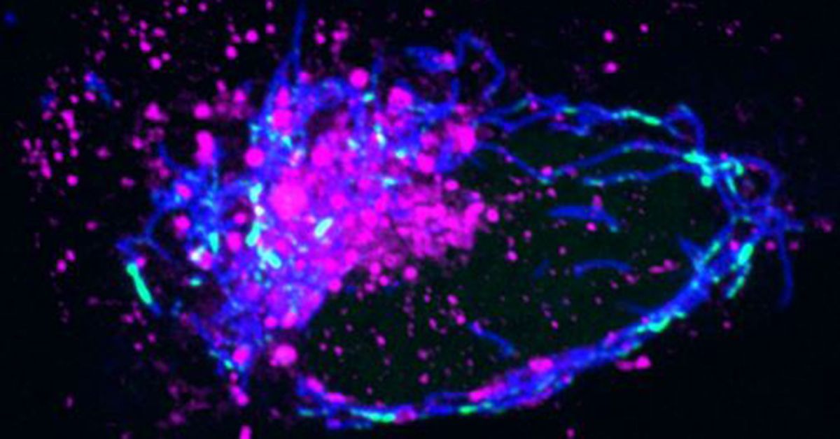 Faulty DNA Disposal System Causes Inflammation