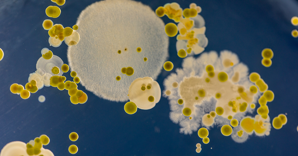 High School Students Learn the Basics of Base Editing to Cure “GFP-itis”