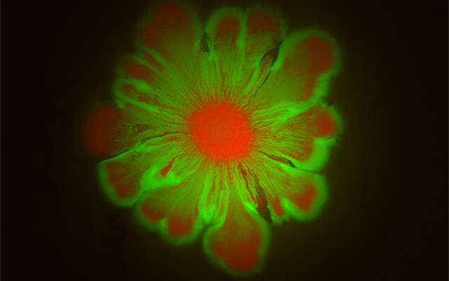Surprising Beauty Found in Bacterial Cultures
